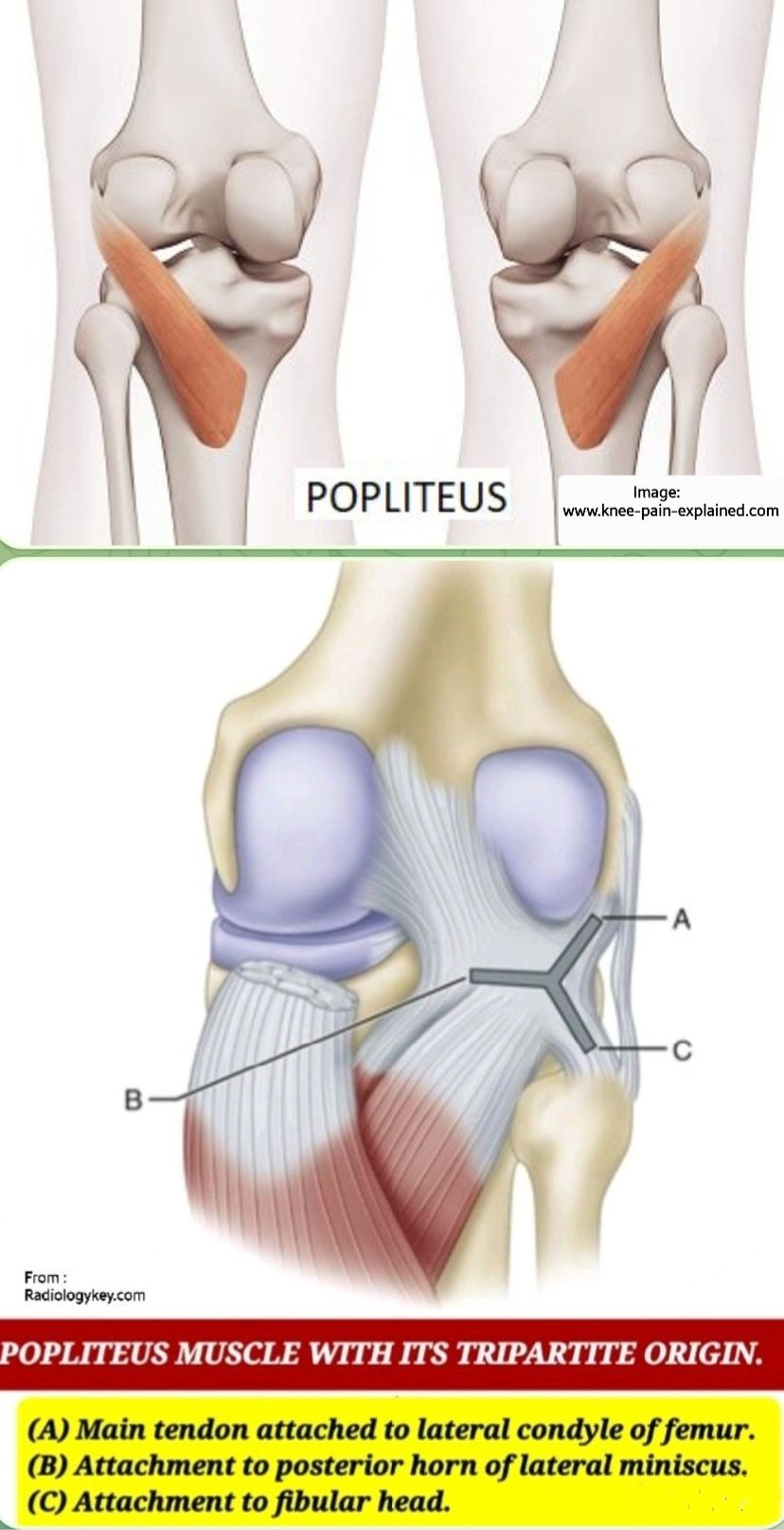 Popliteus Muscle Pain