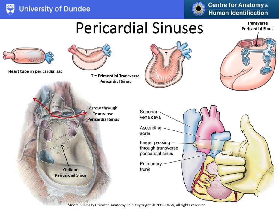 Transverse Pericardial Sinus