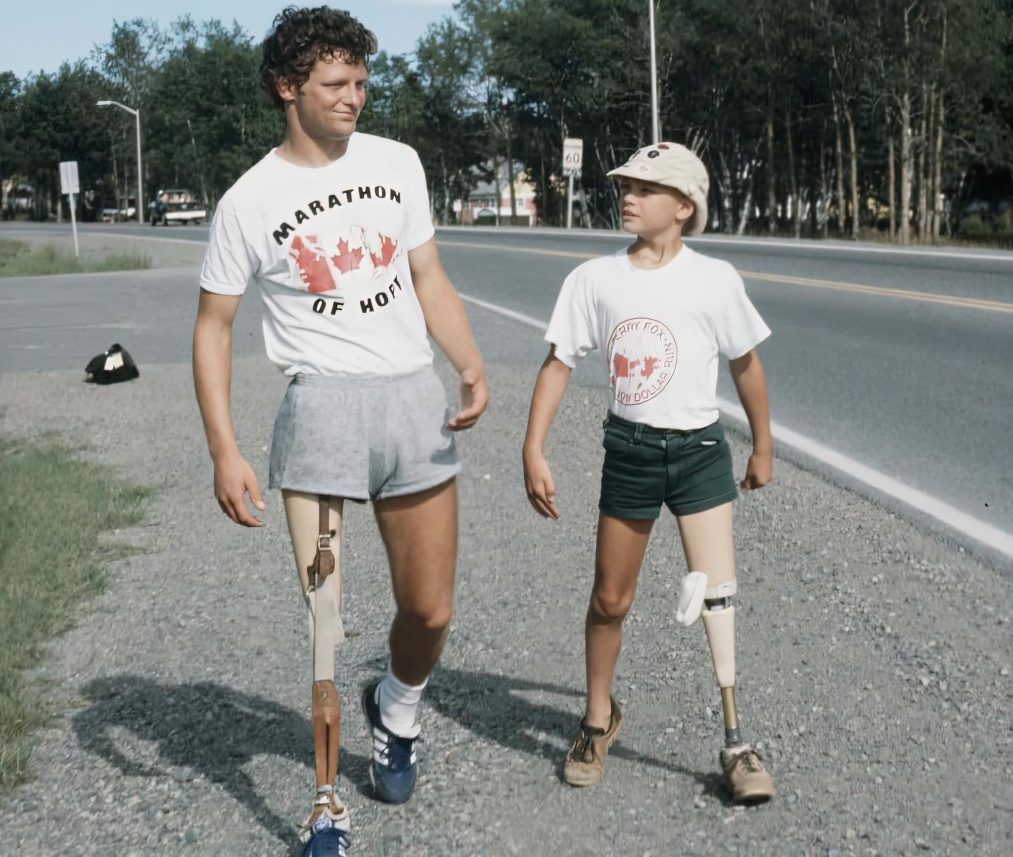 Terry Fox Prosthetic Leg