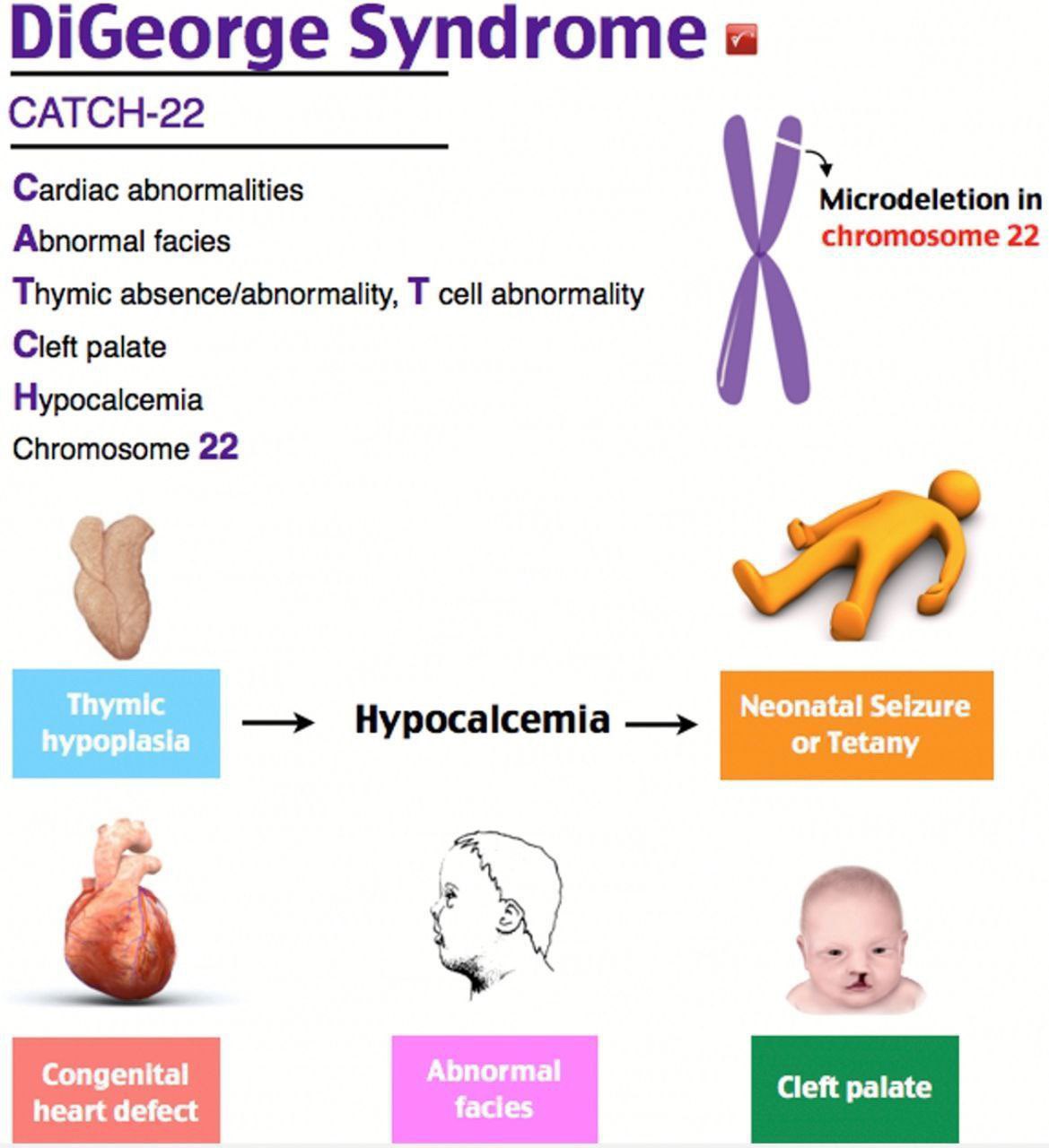Digeorge Syndrome Facies