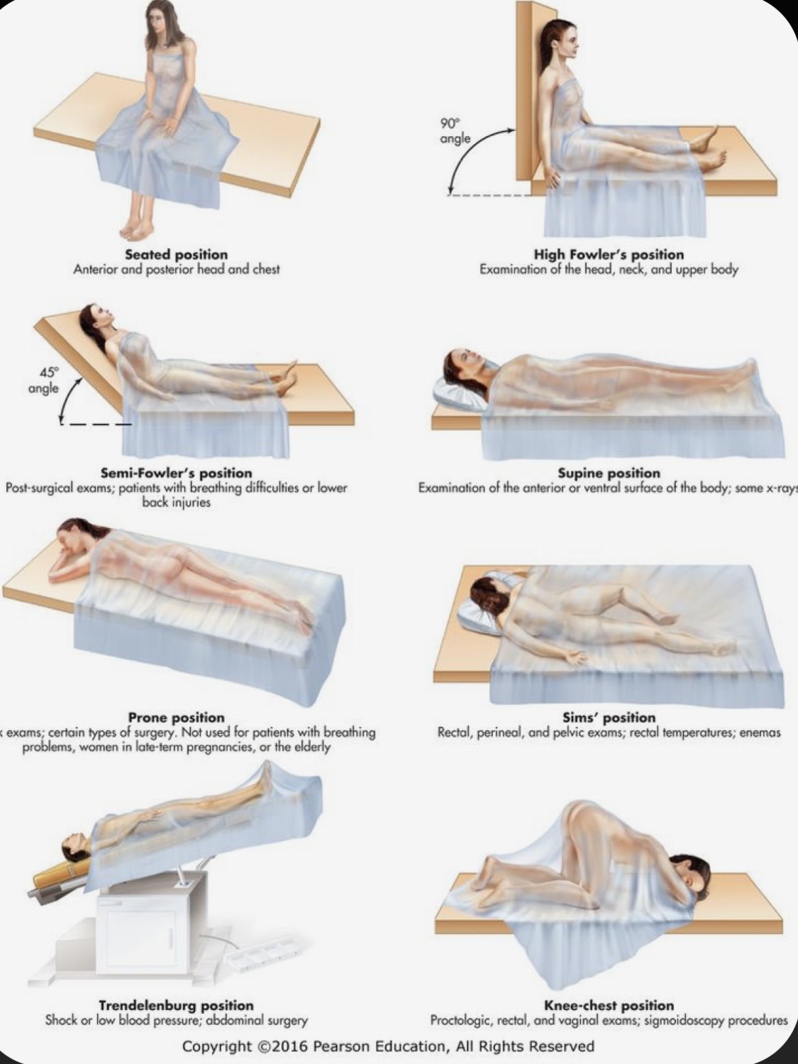 High Fowlers Position