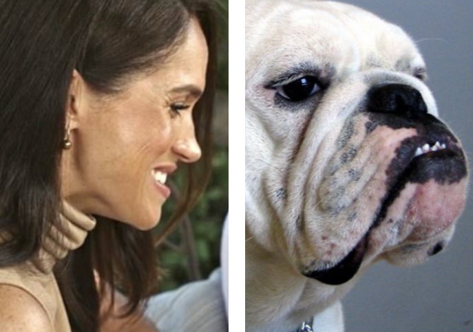 Celebrities With Underbites