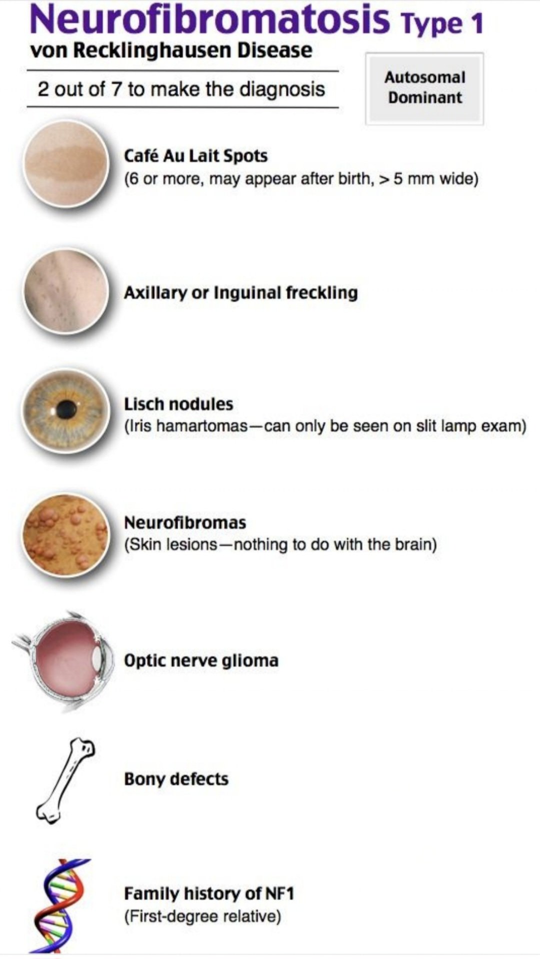 Neurofibromatosis Type 1 Nf1 Mnemonic For Licensing Cell Behavior Of