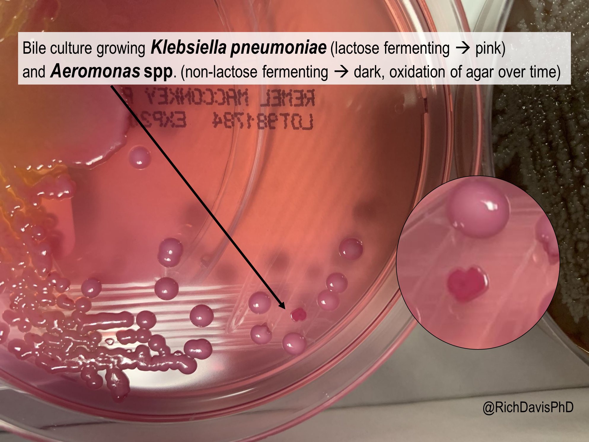 Macconkey Agar Klebsiella Pneumoniae