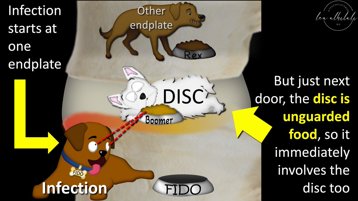 1/Diagnosing discitis can be a pain in the backside! When it’s easy, it ...