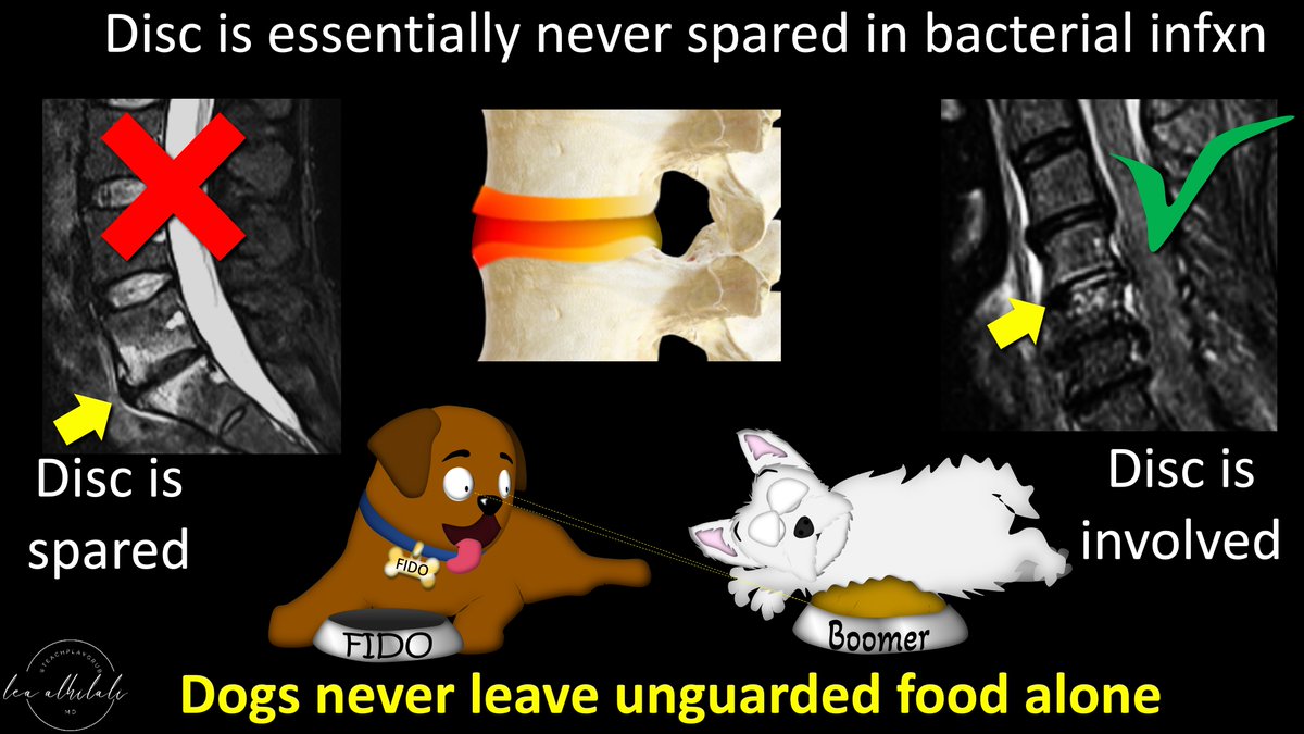 1/Diagnosing discitis can be a pain in the backside! When it’s easy, it ...