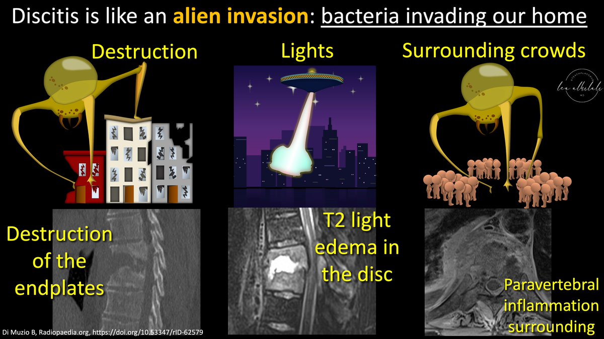 1/Diagnosing discitis can be a pain in the backside! When it’s easy, it ...