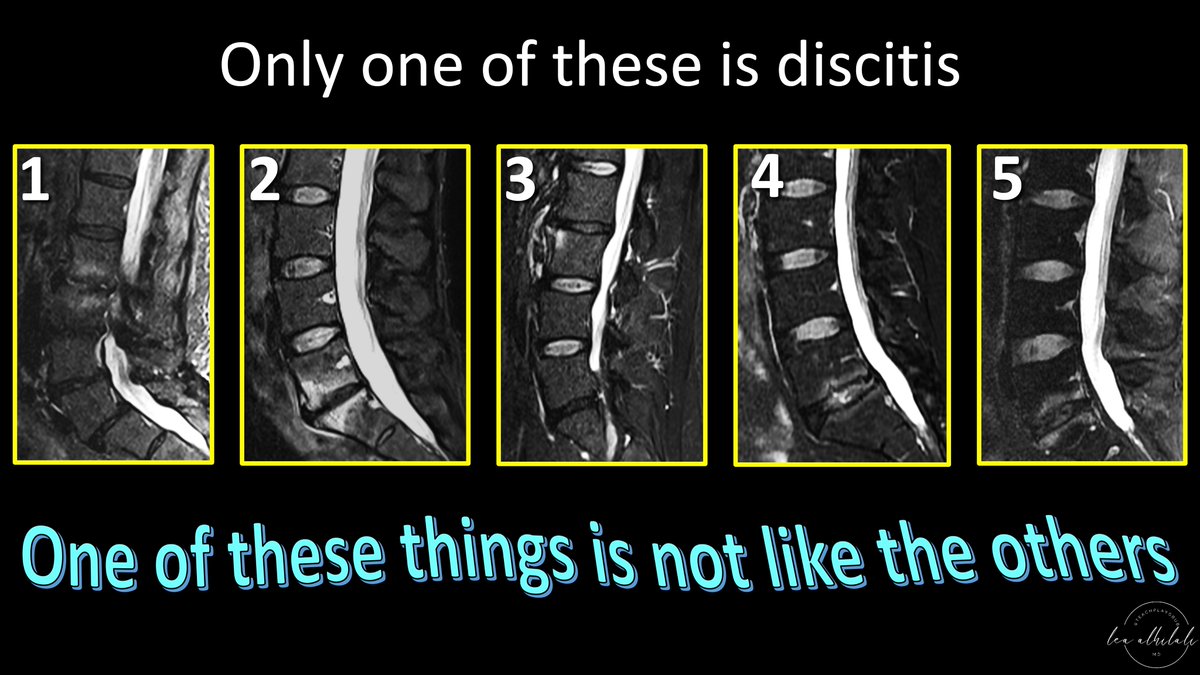 1/Diagnosing discitis can be a pain in the backside! When it’s easy, it ...