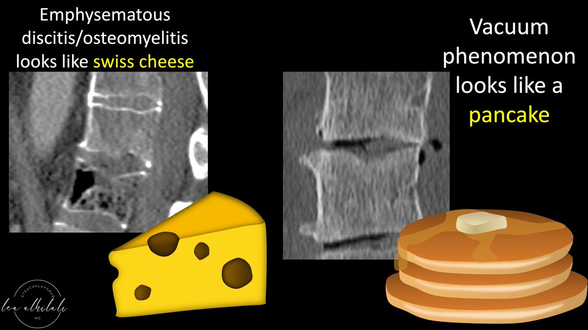 1/Diagnosing discitis can be a pain in the backside! When it’s easy, it ...