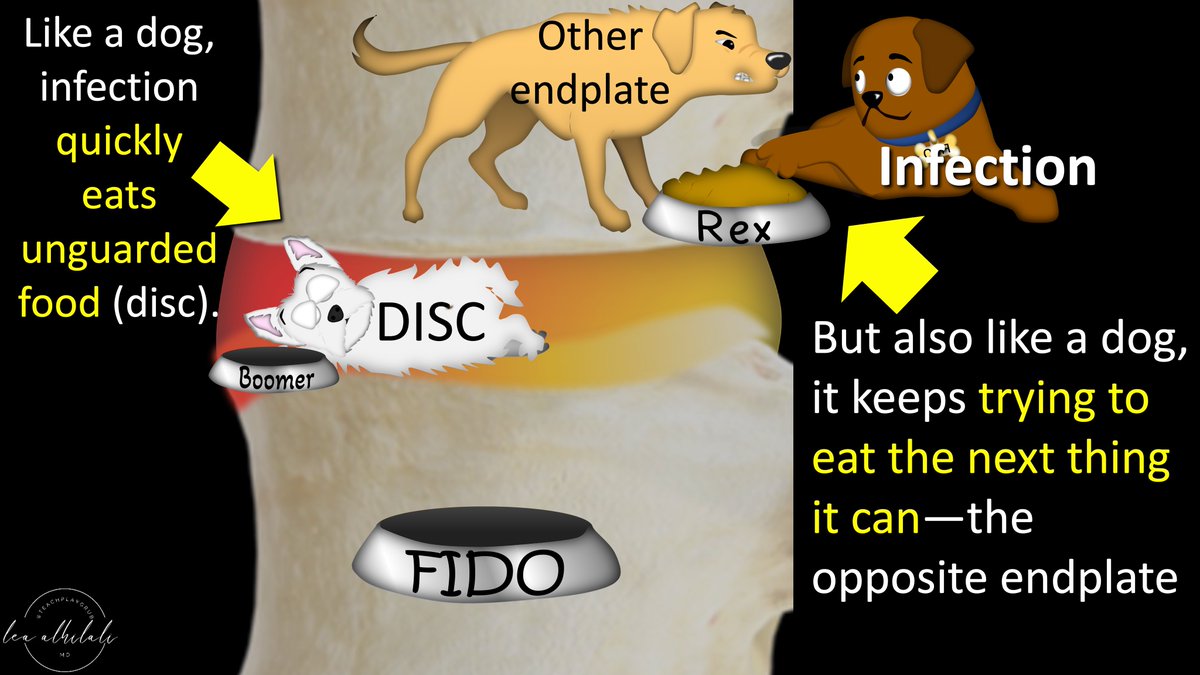 1/Diagnosing discitis can be a pain in the backside! When it’s easy, it ...