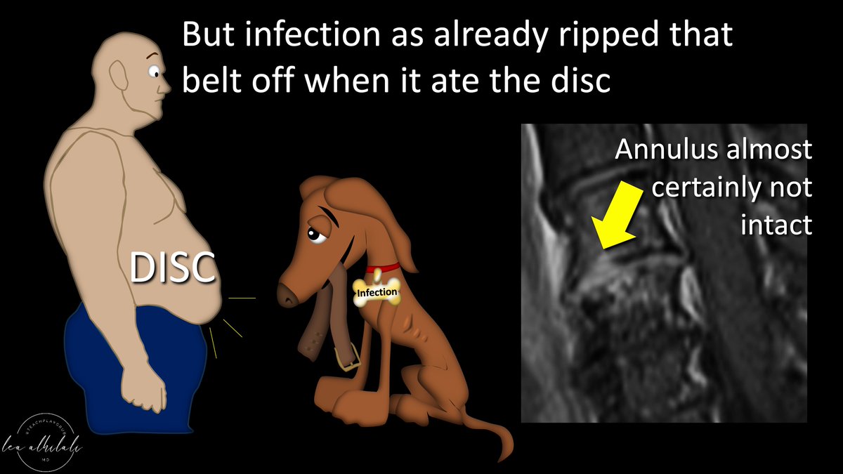 1/Diagnosing discitis can be a pain in the backside! When it’s easy, it ...