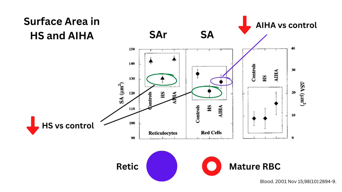 1/6 RBC PARAMETERS IN SPHEROCYTOSIS Spherocytic RBCs result from a loss ...
