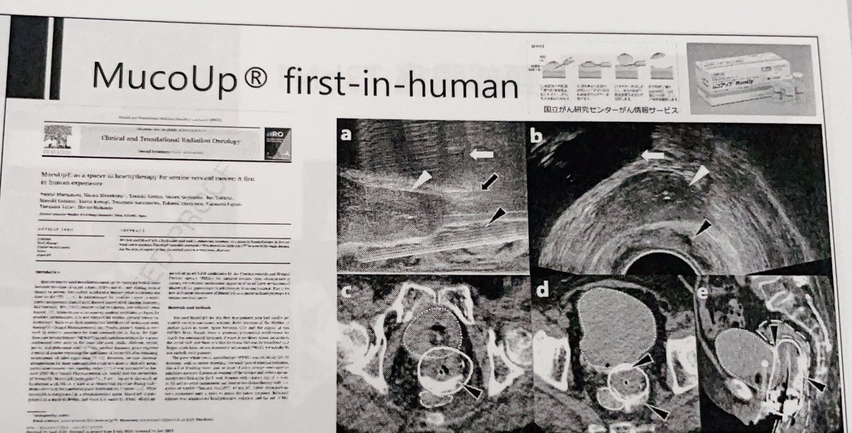Yoichi Muramoto, MD II 放射線治療・データサイエンス(@yoichimuramoto) - Twilog (ツイログ)