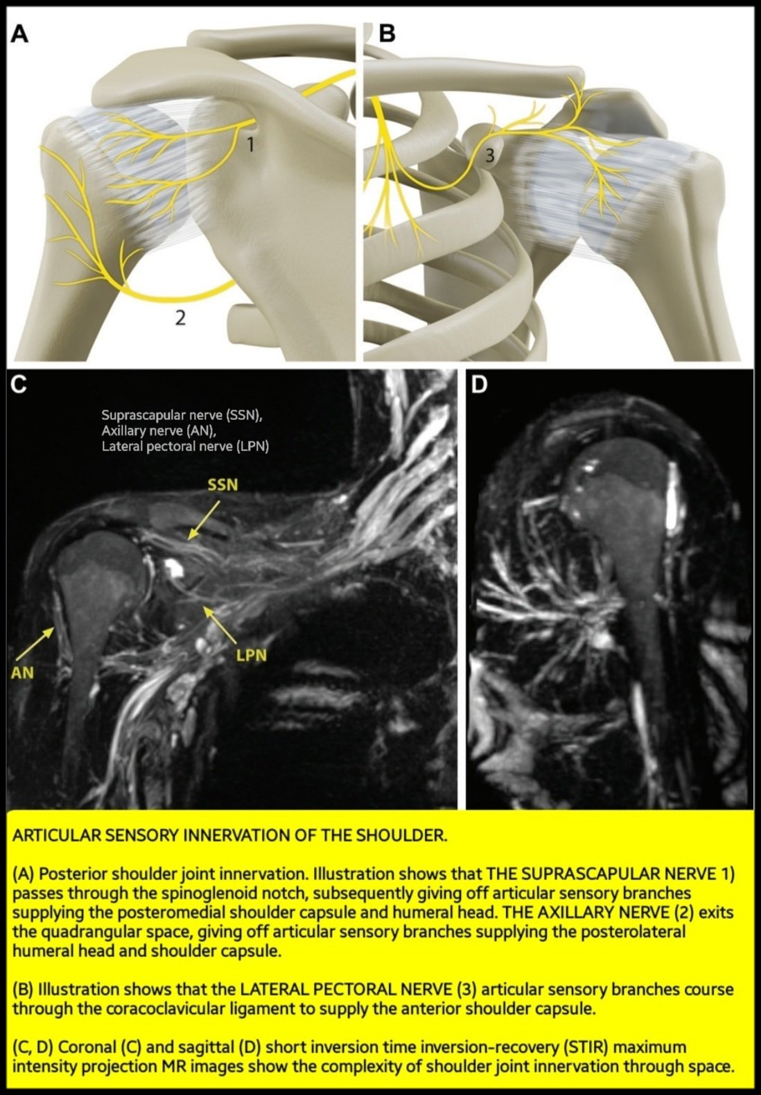 Suprascapular Nerve