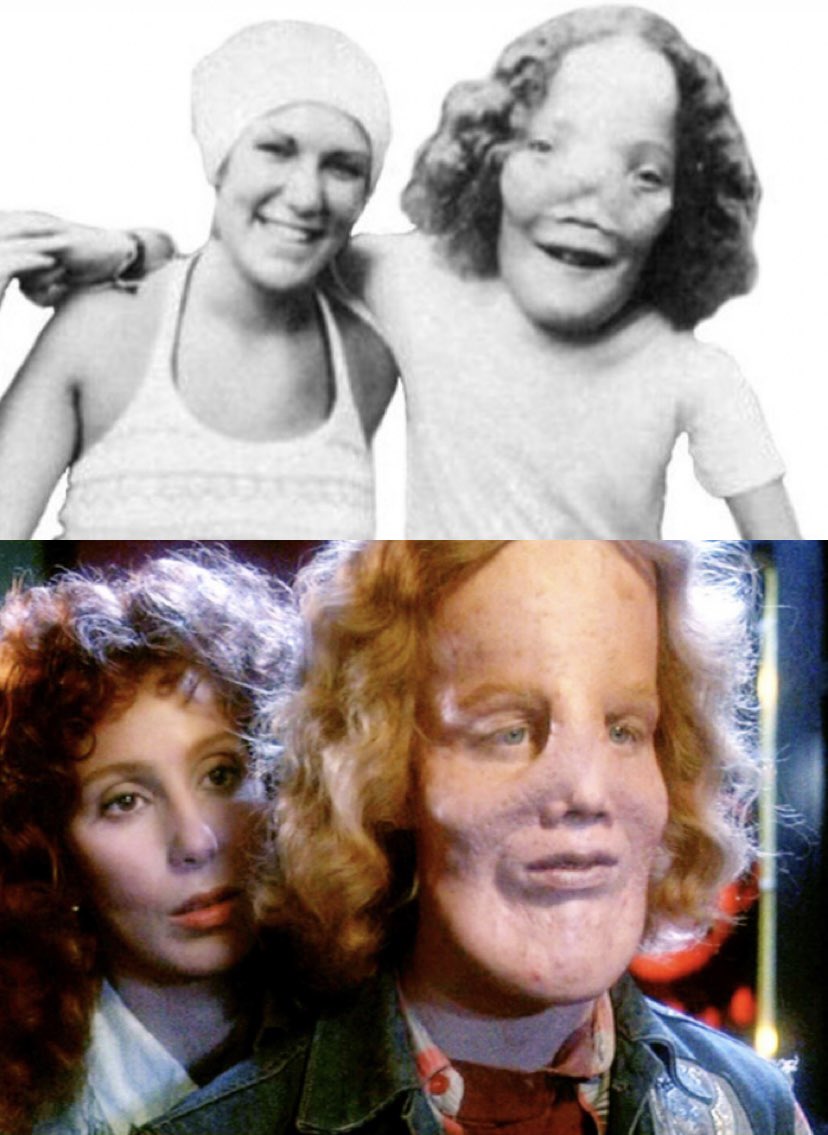 Rocky Dennis Real Life