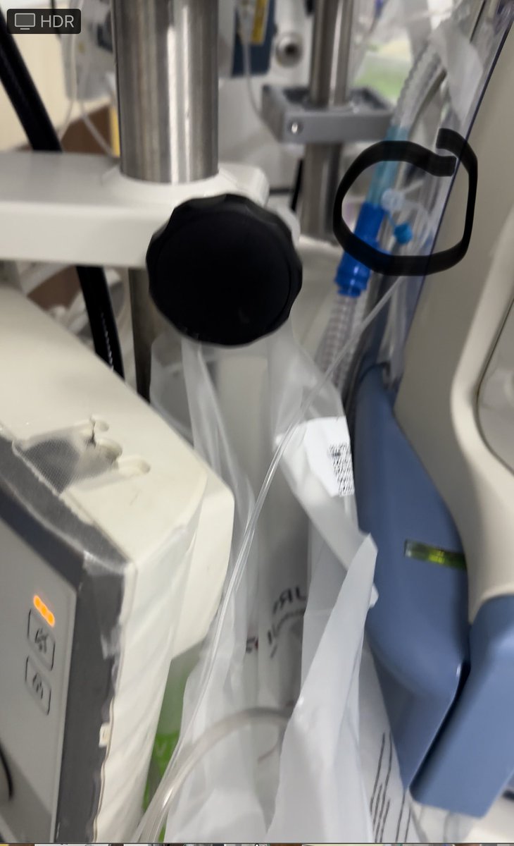 دائما تسمع مو كل RT عنده خبرة في Inhaled nitric oxide therapy؟ ثريد عن ...