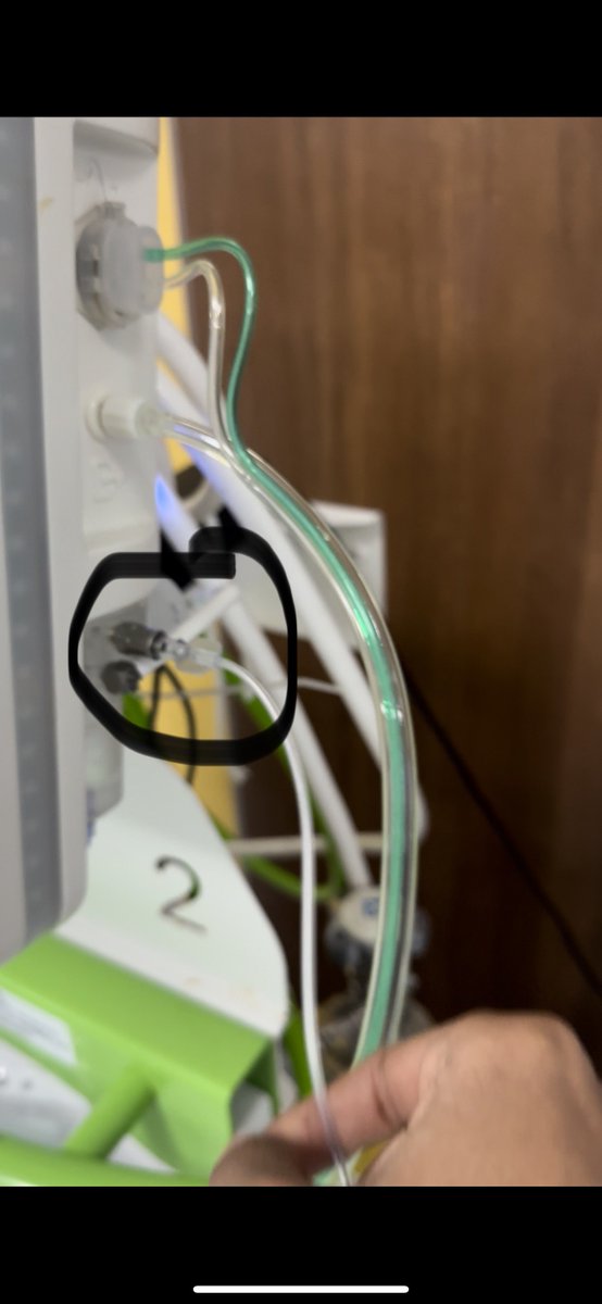 دائما تسمع مو كل RT عنده خبرة في Inhaled nitric oxide therapy؟ ثريد عن ...