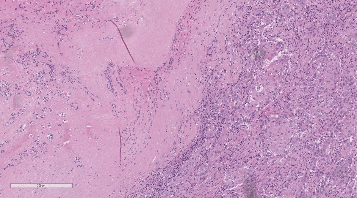 Michał Kunc, MD (@MKunc_MD) / Posts / X