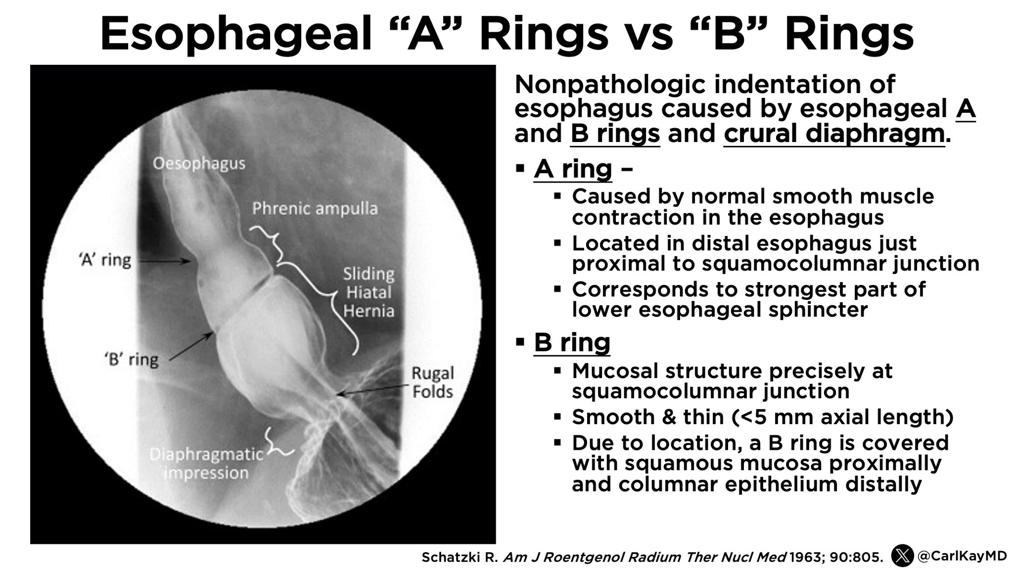 Squamocolumnar Junction Mucosa