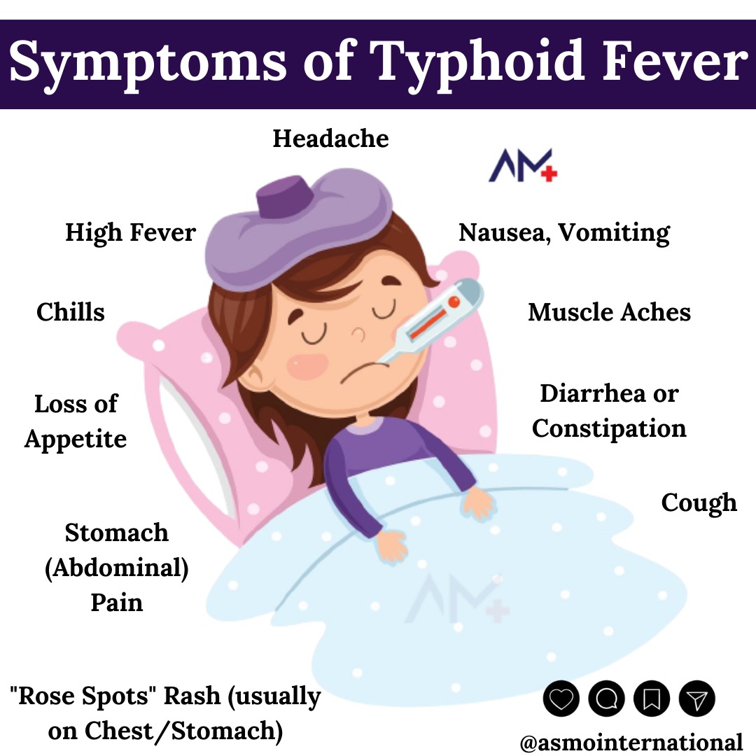 Typhoid Fever Rash