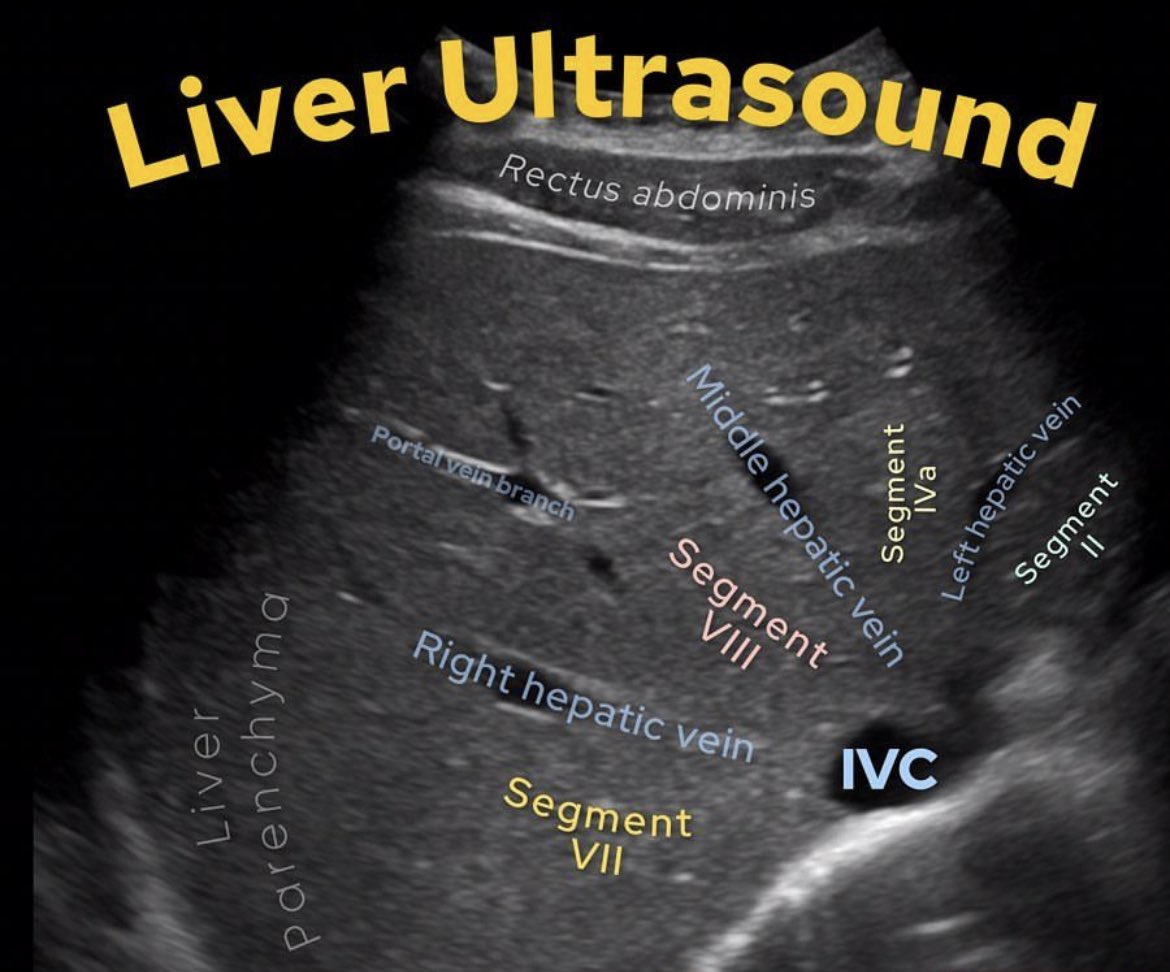 Bunny Rabbit Sign Ultrasound Bunny Zodiac | Zodiac Signs Animals,