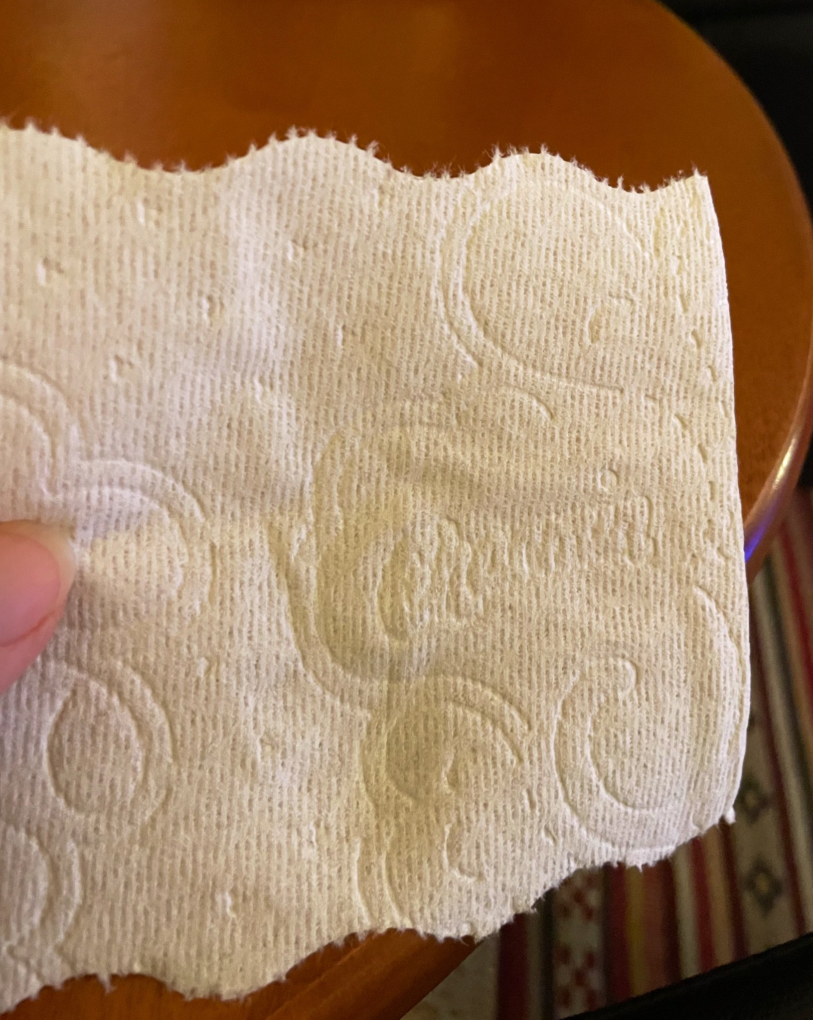 Pinworms On Toilet Paper Diagnosing Pinworms | Pinworm Infection | CDC