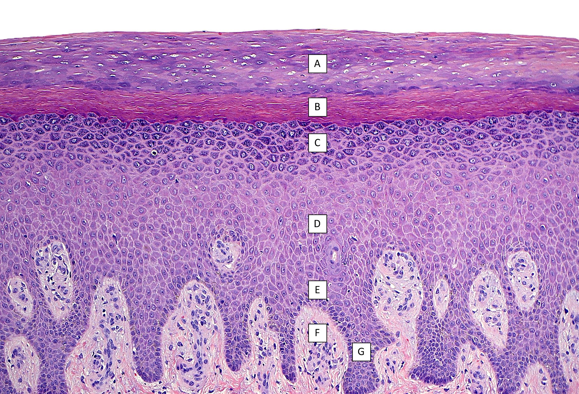 Layers Of Epidermis Histology