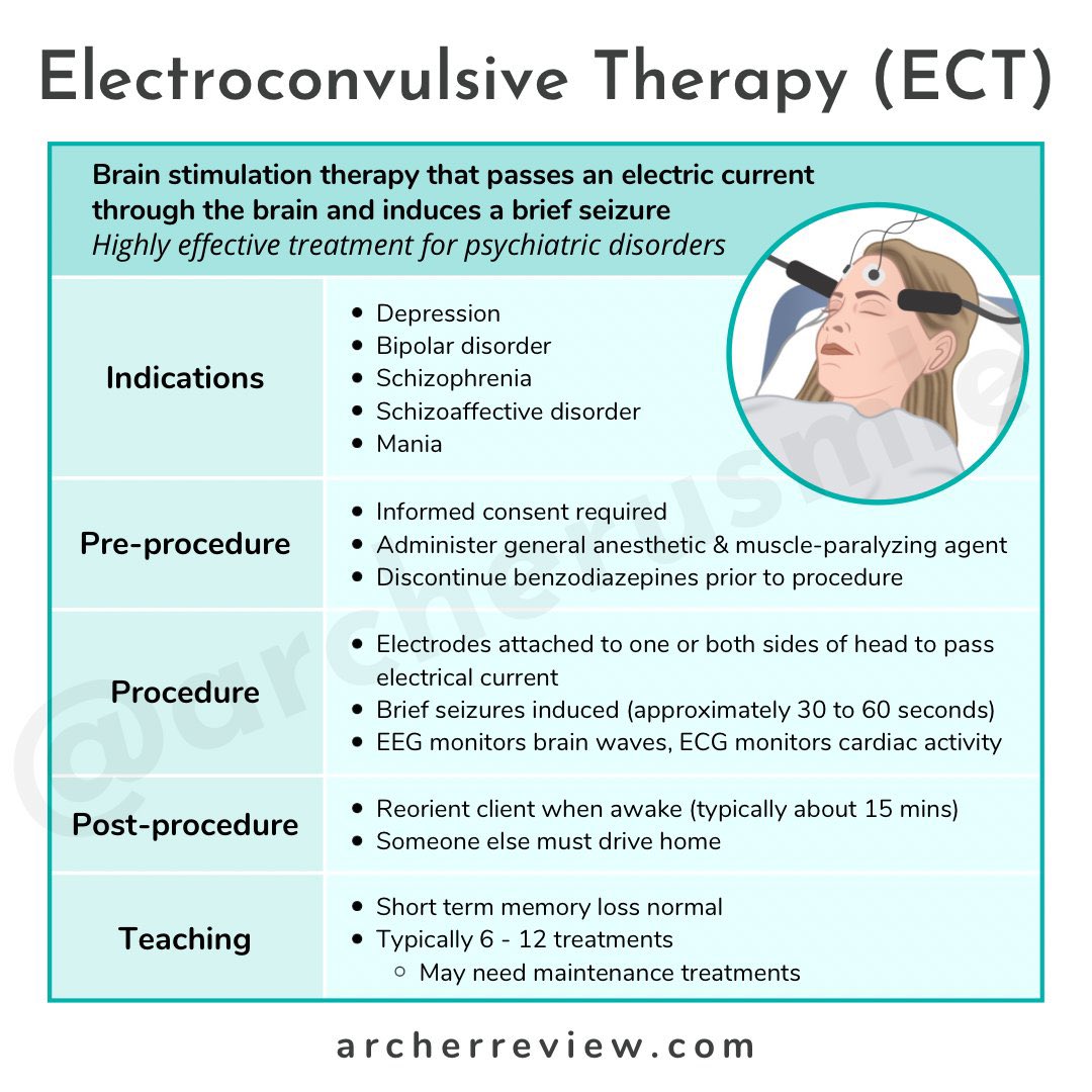 Electroconvulsive Therapy Procedure