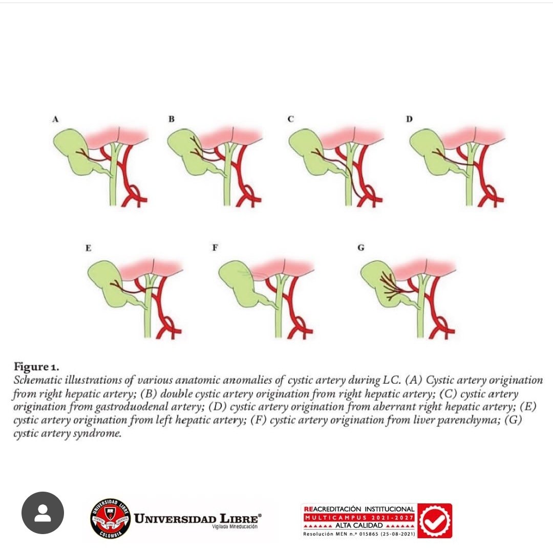 Variaciones De La Arteria Cística