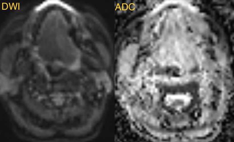 Thread by @daniel_gewolb on Thread Reader App – Thread Reader App