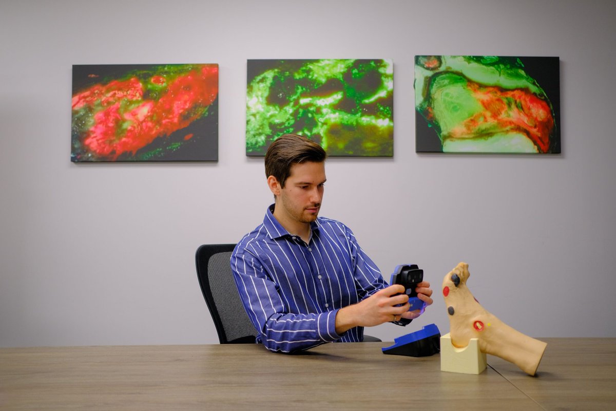 MolecuLight Inc | Advanced Wound Care Solutions