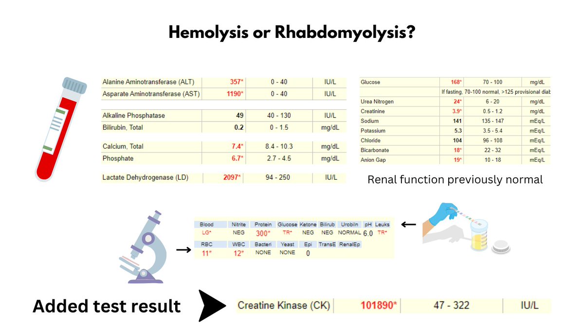 1/2 HEMOLYSIS vs. RHABDO Earlier this week, I tweeted a series of labs ...