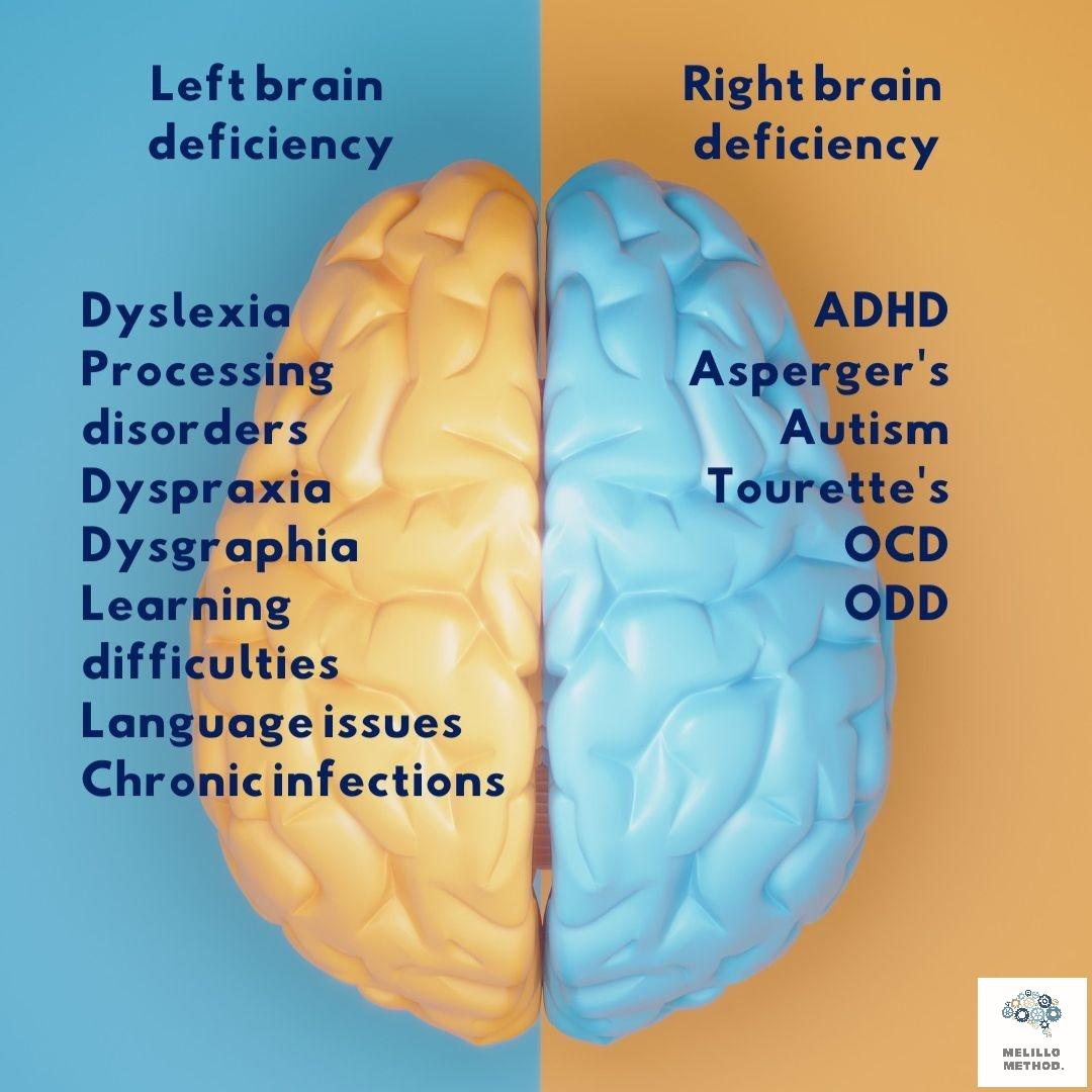 Part Of The Left Brain