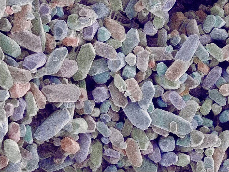 Image Inner Ear Calcium Rocks Your Dizzy Spells Could Be Caused By