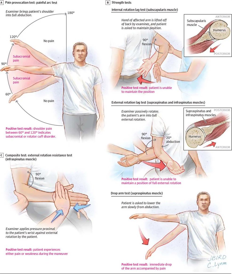 Shoulder Rotator Cuff Tests Shoulder Pain Treatment Near Me In