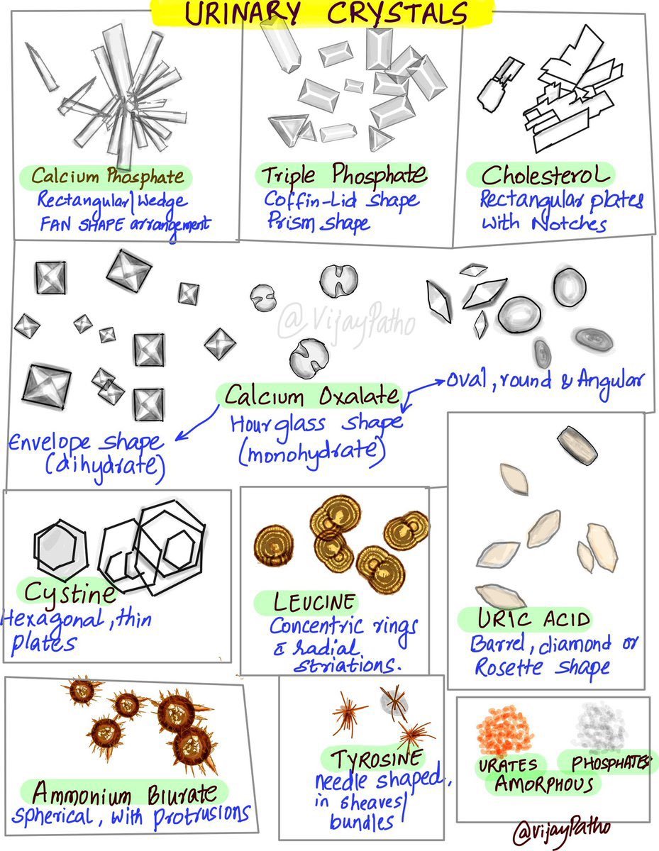 Calcium Phosphate Crystals In Urine