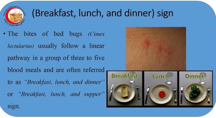 Breakfast Lunch And Dinner Sign