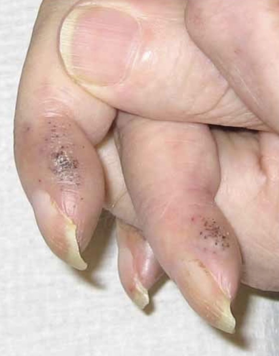 Careful evaluation of the hands 🤲 is a fundamental part of the physical ...