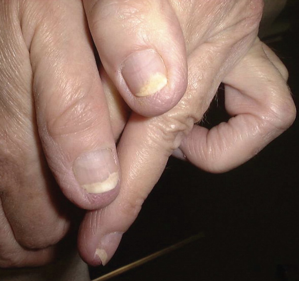 Careful evaluation of the hands 🤲 is a fundamental part of the physical ...