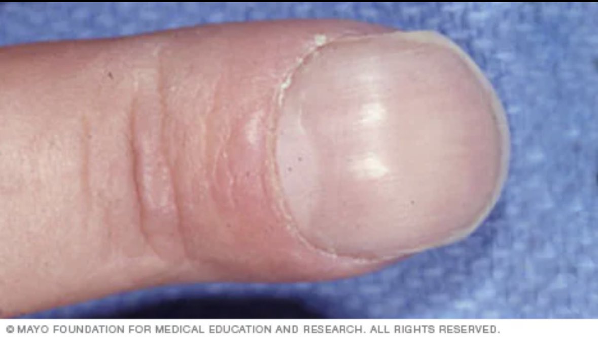 Careful evaluation of the hands 🤲 is a fundamental part of the physical ...