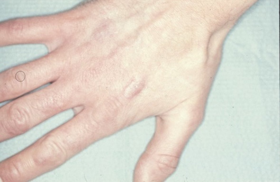 Careful evaluation of the hands 🤲 is a fundamental part of the physical ...