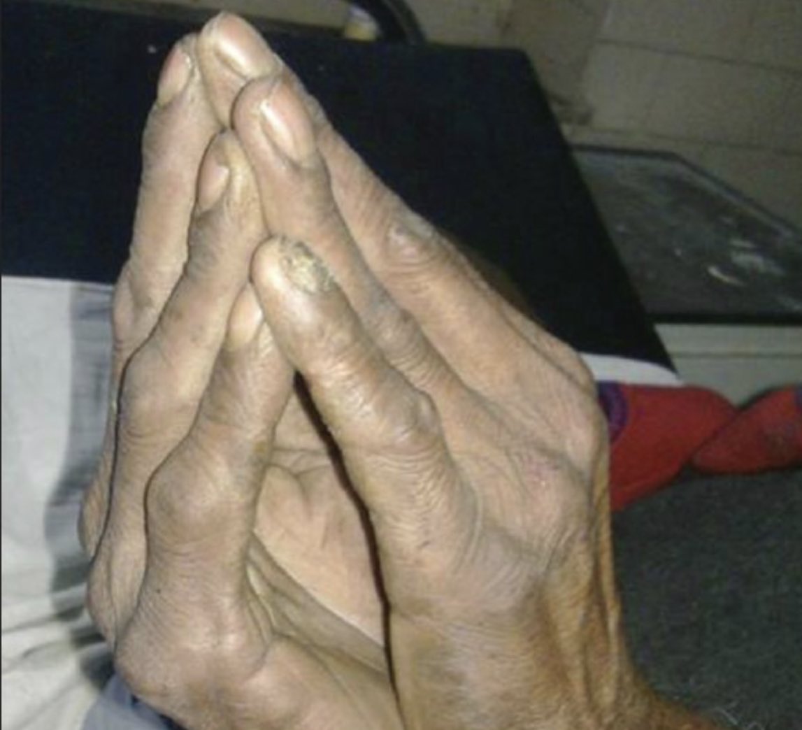 Careful evaluation of the hands 🤲 is a fundamental part of the physical ...