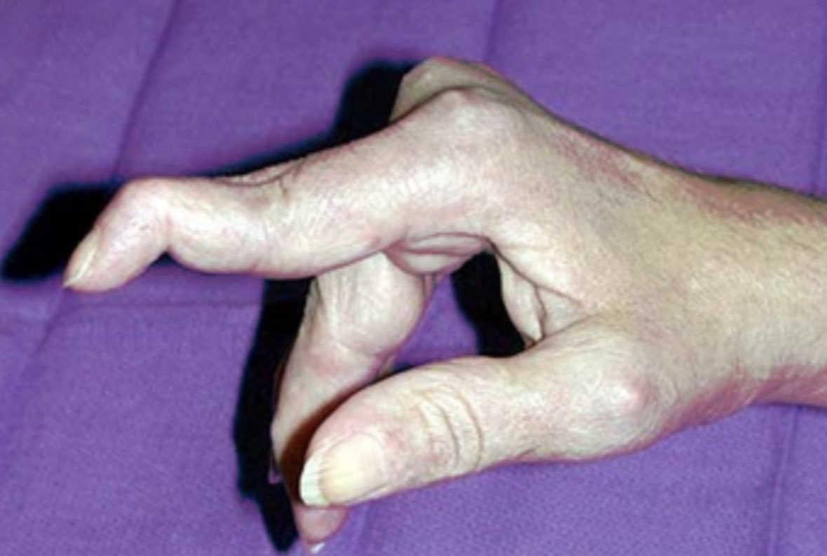 Careful evaluation of the hands 🤲 is a fundamental part of the physical ...