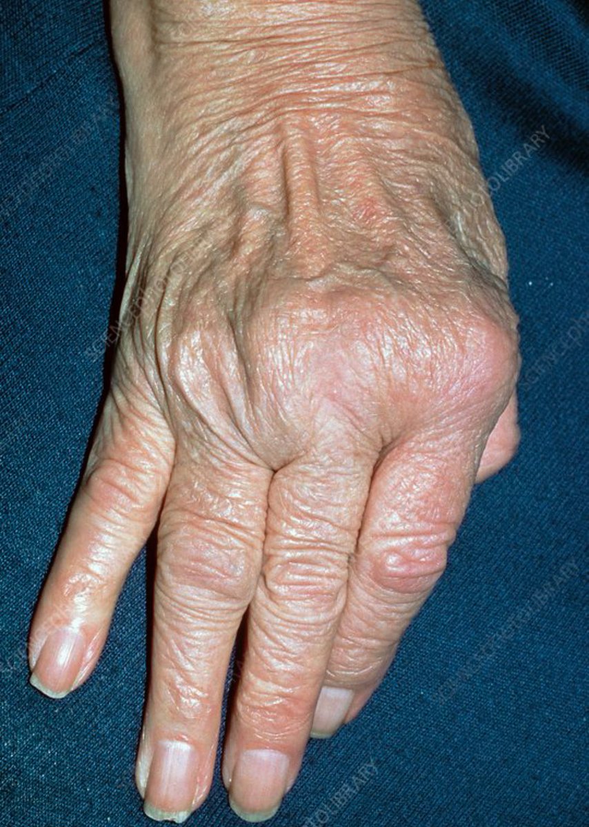 Careful evaluation of the hands 🤲 is a fundamental part of the physical ...