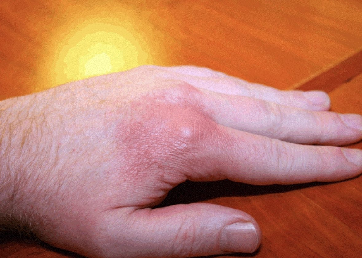 Careful evaluation of the hands 🤲 is a fundamental part of the physical ...