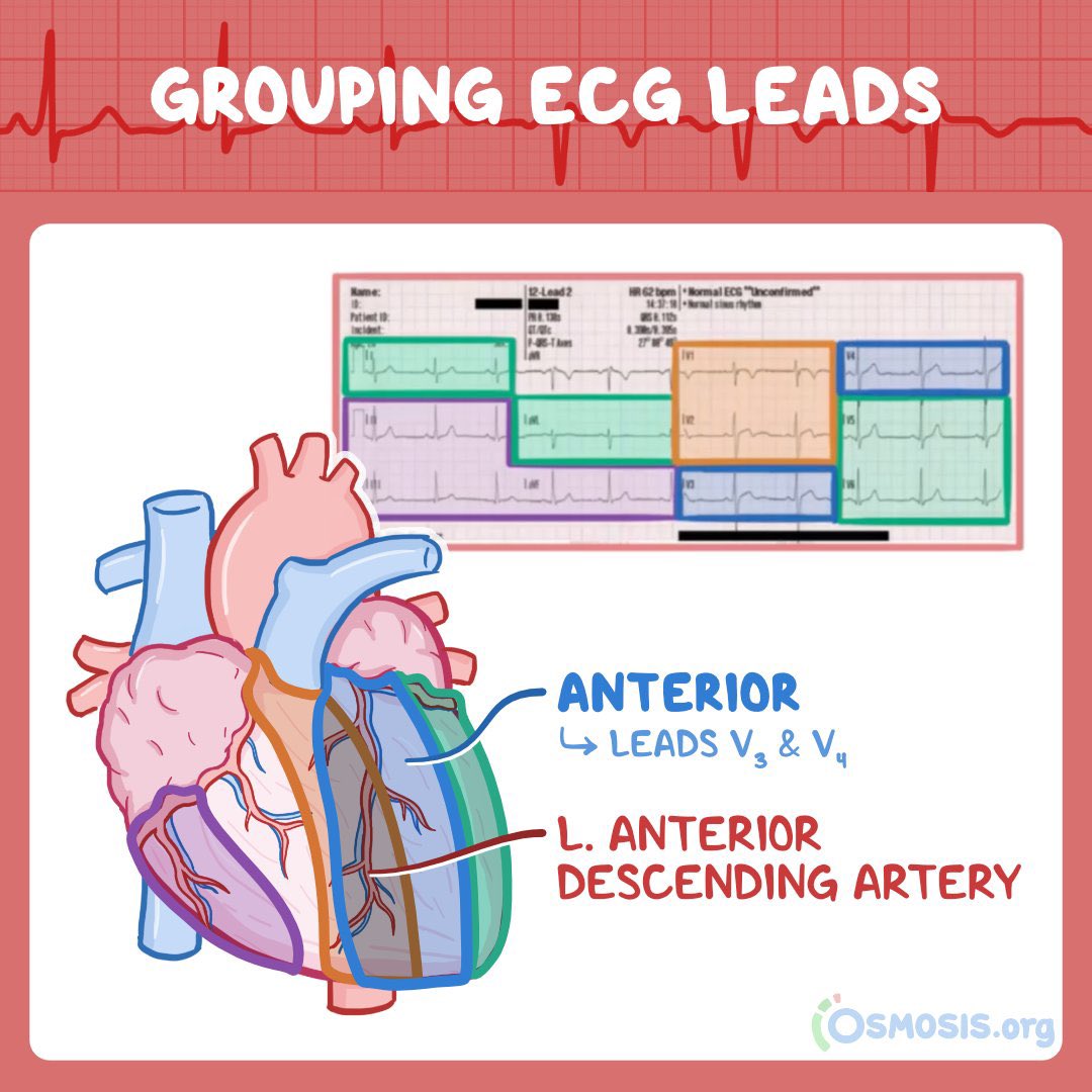 Ecg Leads