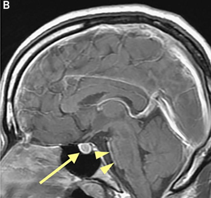 1/6 Time for another interesting case of the week! An 80M presents with ...