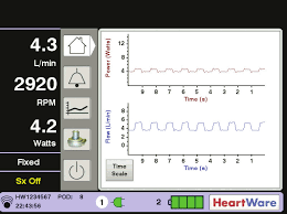 How do you relate the parameters and hemodynamics of continuous-flow ...