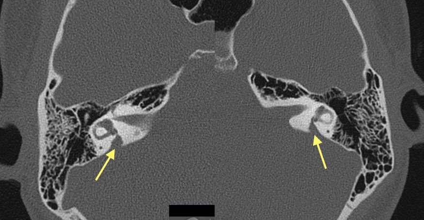 Thread by @daniel_gewolb on Thread Reader App – Thread Reader App