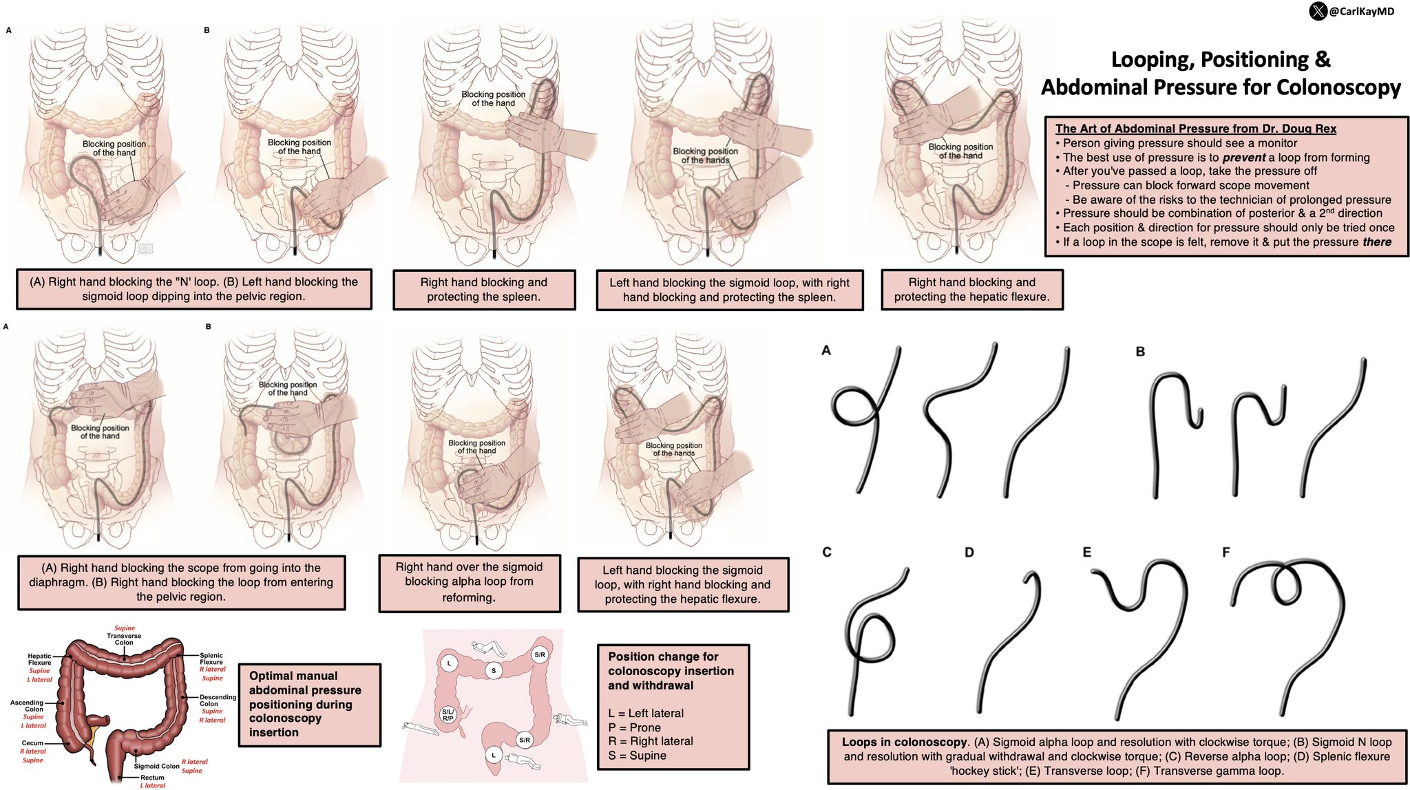 Colonoscopy Positioning